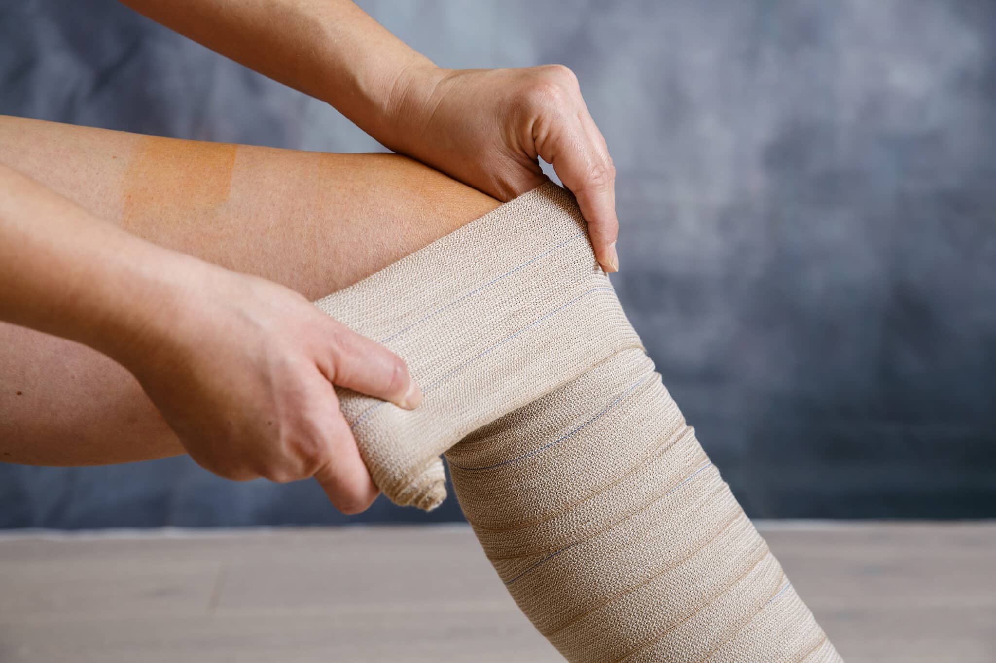 How to Heal a Chronic Venous Leg Ulcer and Keep it Healed