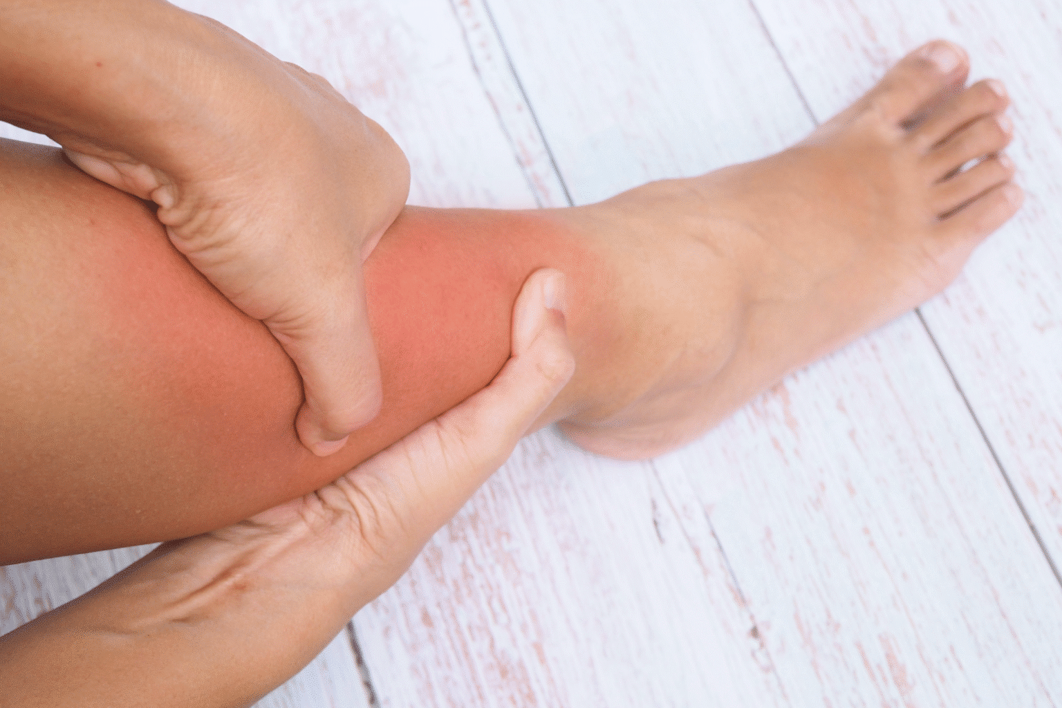 Leg Swelling with a Clot - Inovia Vein Specialty Centers